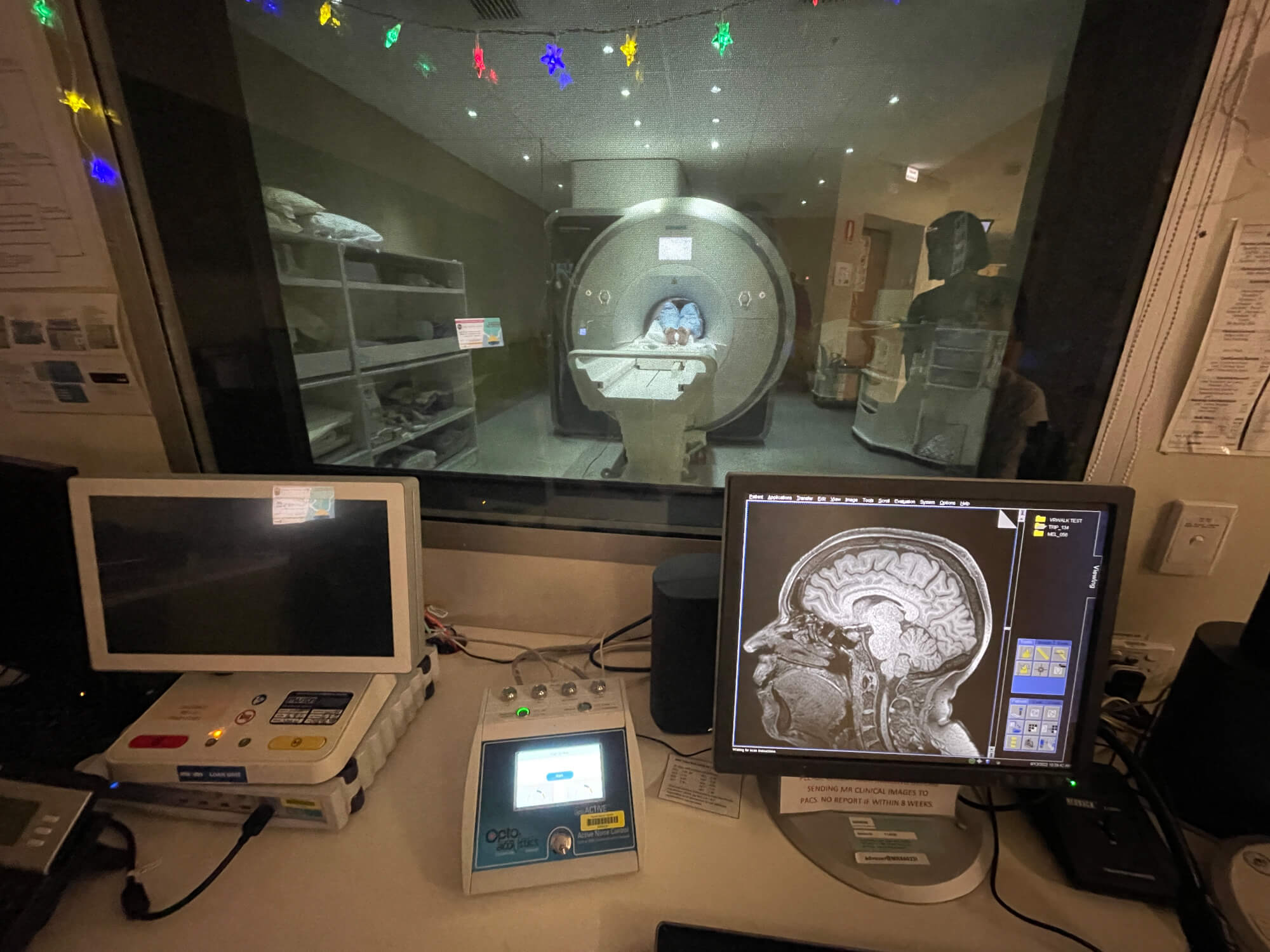 RBWH Foundation : Project: Neurology 1