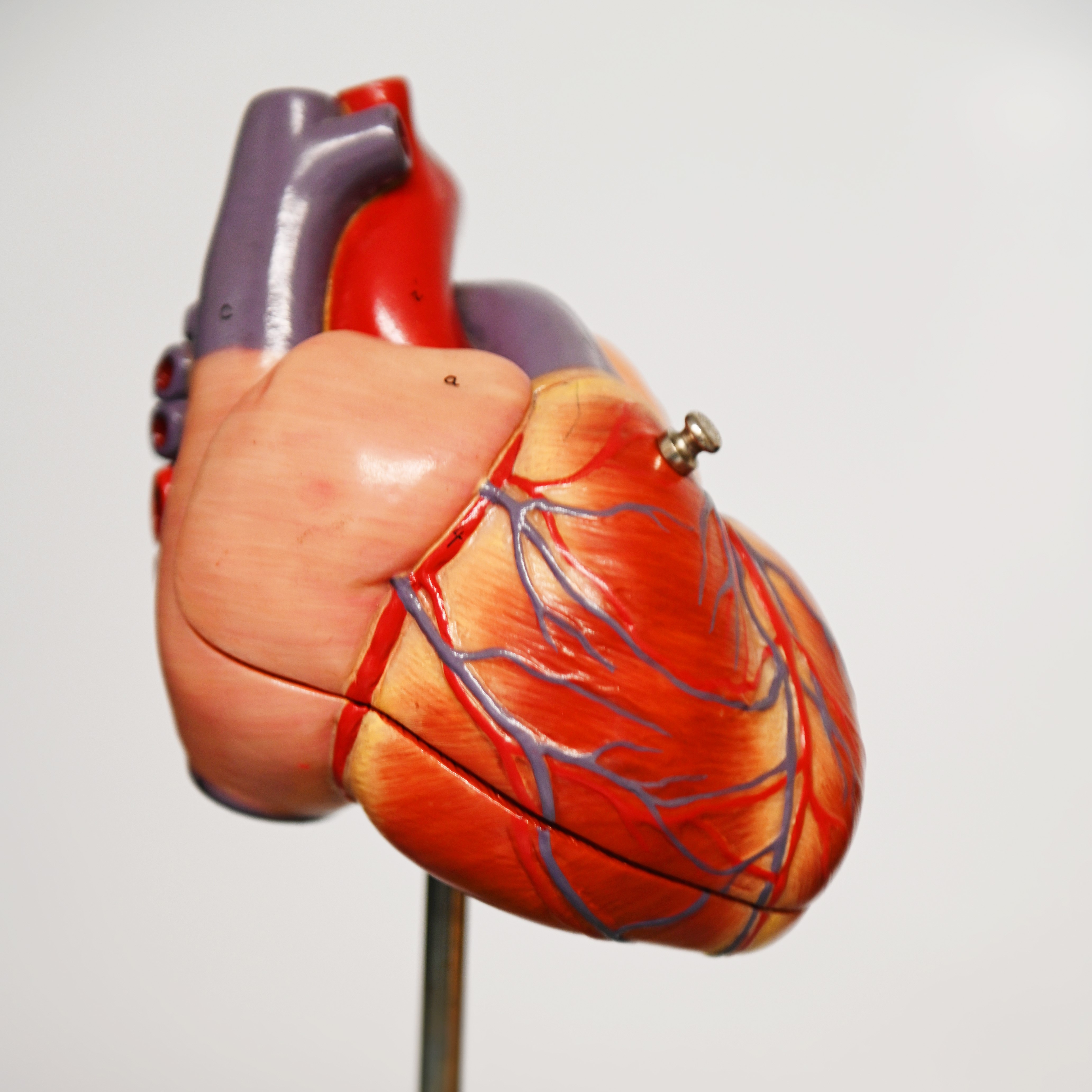RBWH Foundation : Project: An Investigation of the relationship between ...